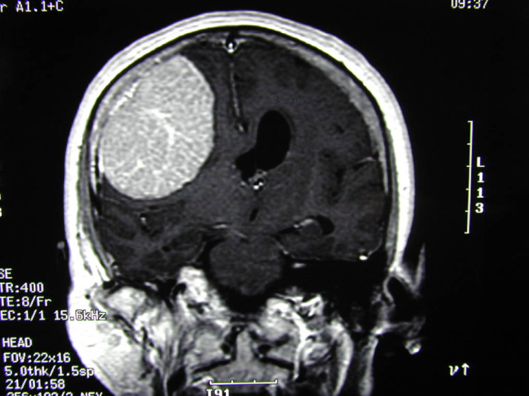 Conditions & Treatments | SC Neurosurgeons | Florence Neuro