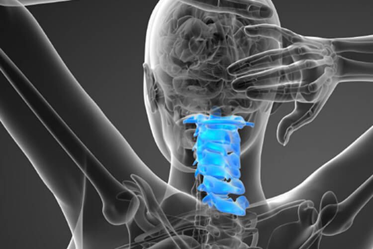 Conditions & Treatments | SC Neurosurgeons | Florence Neuro